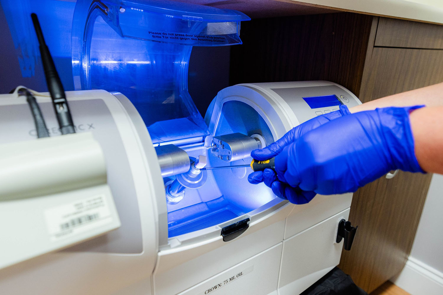 CEREC Reconstruction - Satterfield Family Dental